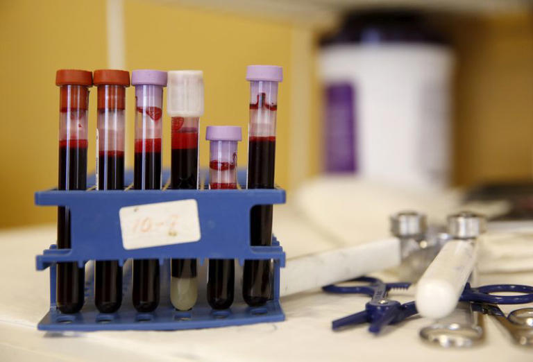 Legend's experimental cell therapy shows promise in blood cancer patients