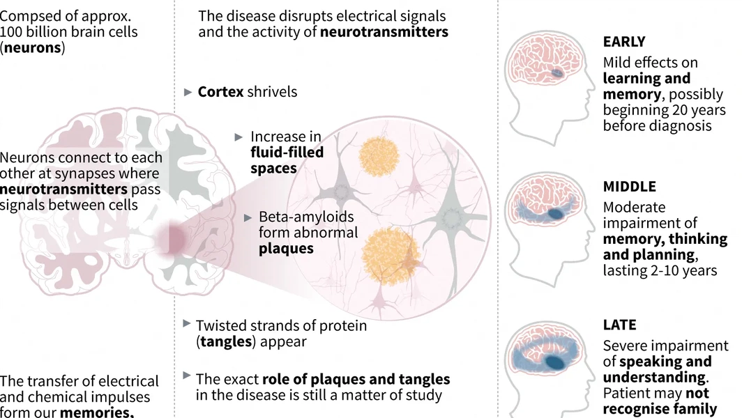 Midlife blood test shows promise for early Alzheimer’s risk detection