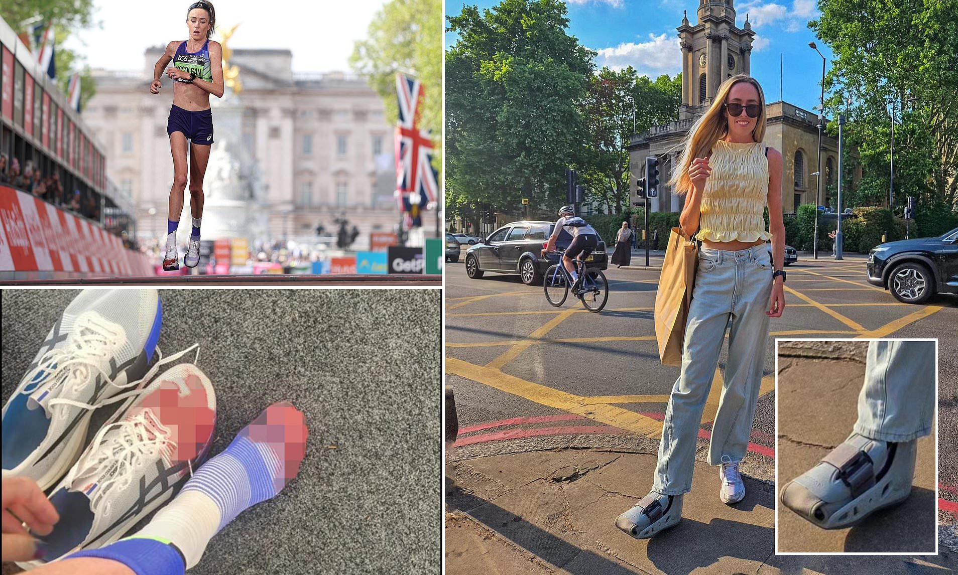 Eilish McColgan wearing a 'moon boot' after painful London Marathon injury