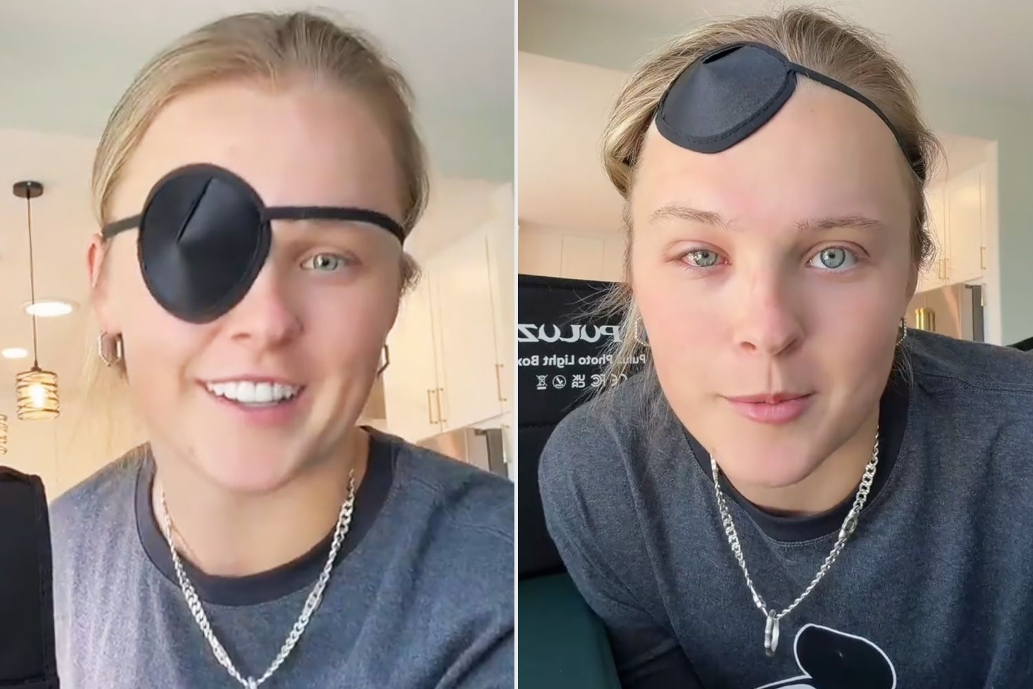 JoJo Siwa shows off 'gnarly' eye infection after getting thrown from ...
