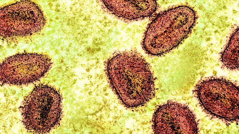 Foreign nationals working at NIH charged with smuggling m-pox into US ...