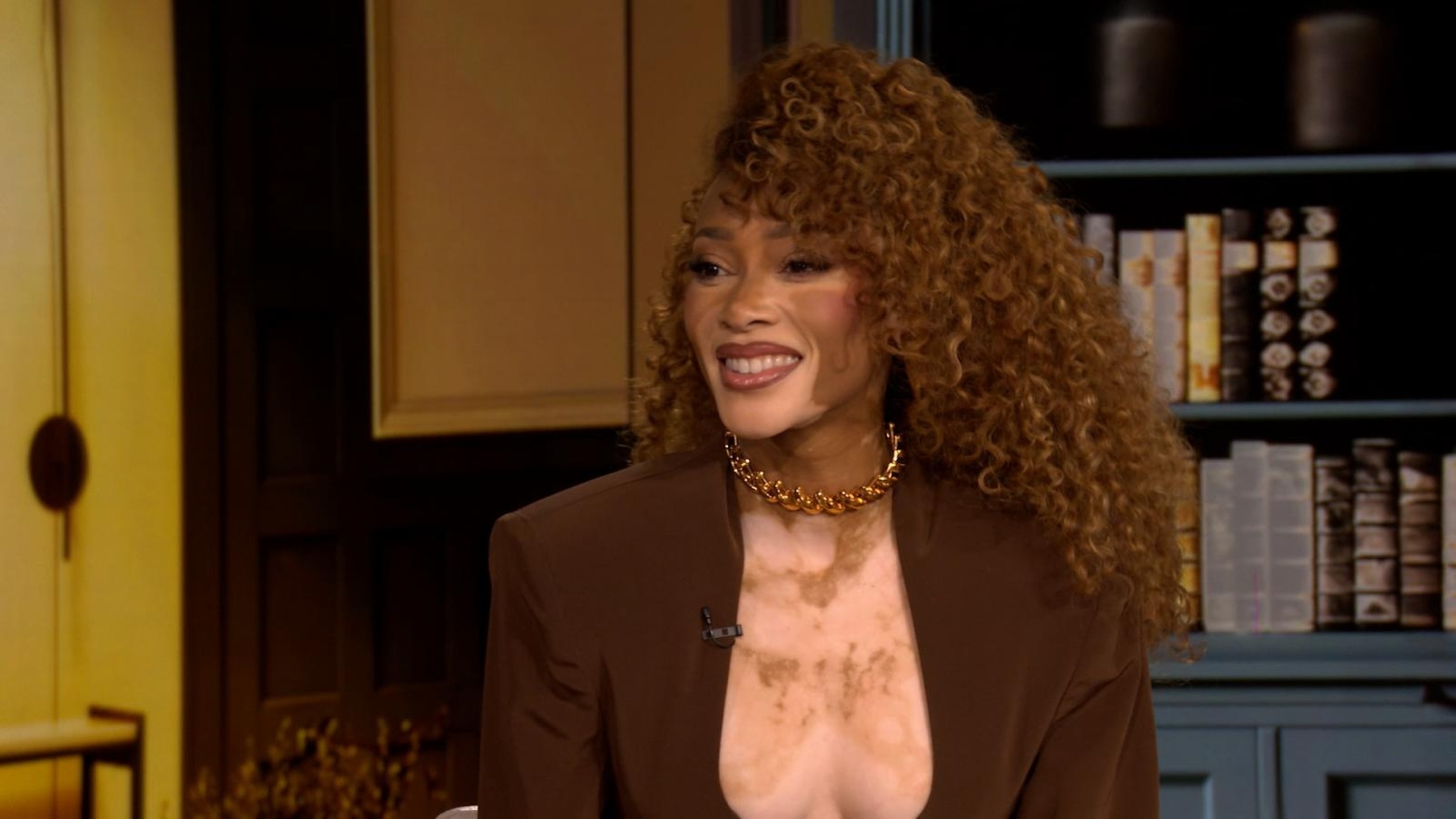 Model to mogul to children’s book author: Winnie Harlow expands her career