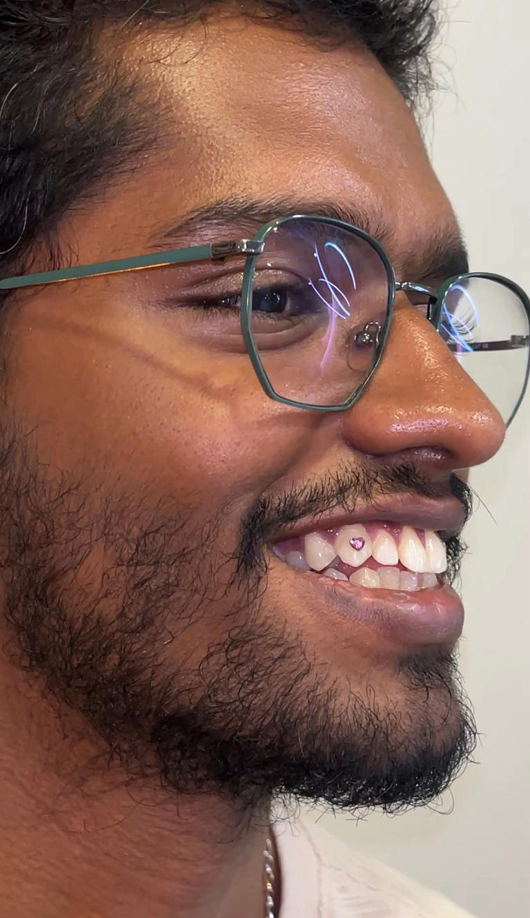 Bedazzle the smile: Teeth accessories make a comeback among millennials ...