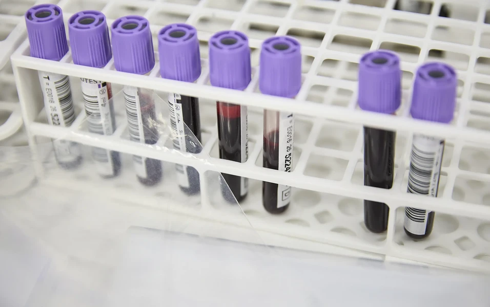 What your blood tests can reveal about you