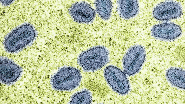 Foreign nationals working at NIH charged with smuggling m-pox into US ...