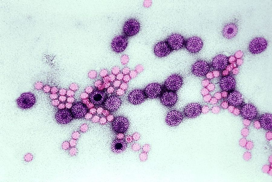Presence of rare infection that can be severe in kids declines, except ...