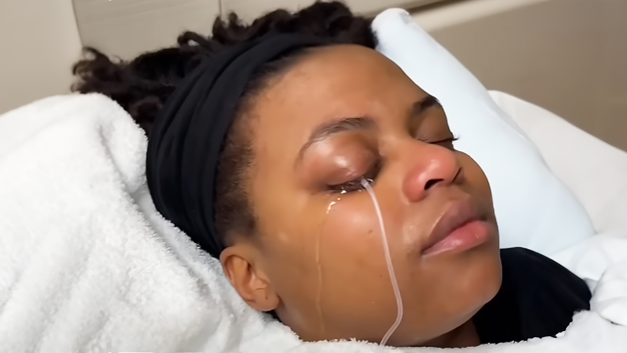 Doctor explains how chemicals are removed from the eyes