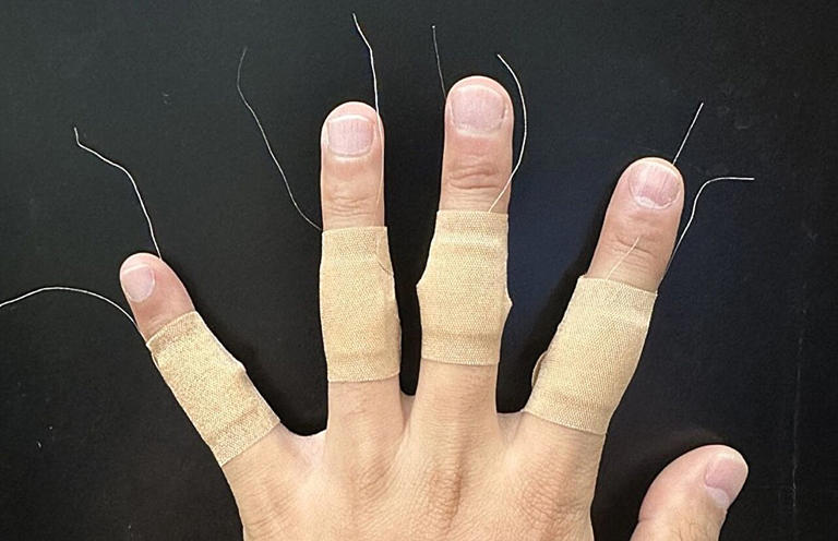 New hand sensors turn post-stroke rehab into an on-screen game