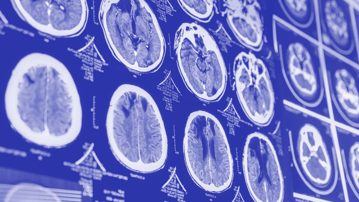 4DMedical shares fall despite new clinical program, European expansion
