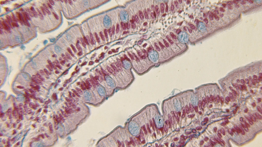 High-fiber diet found to cut daily calorie absorption