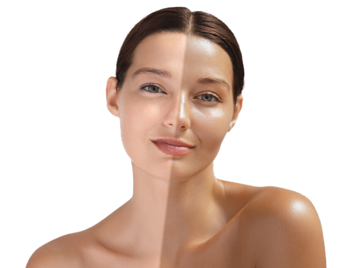 Fairness cream side effects: Dermatologist warns facial hair, redness ...