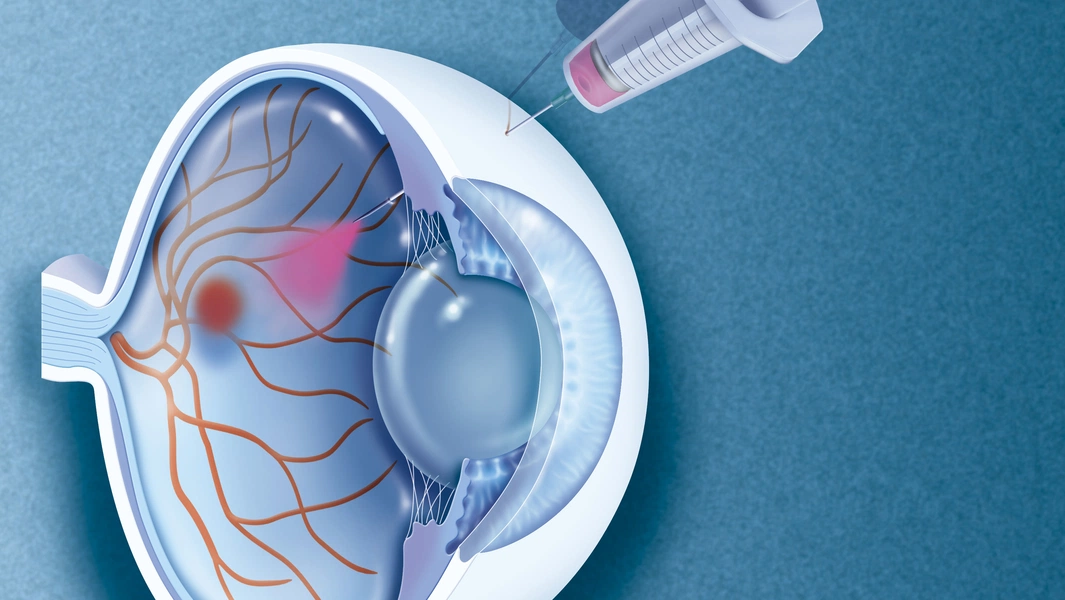 Warning signs of serious eye conditions