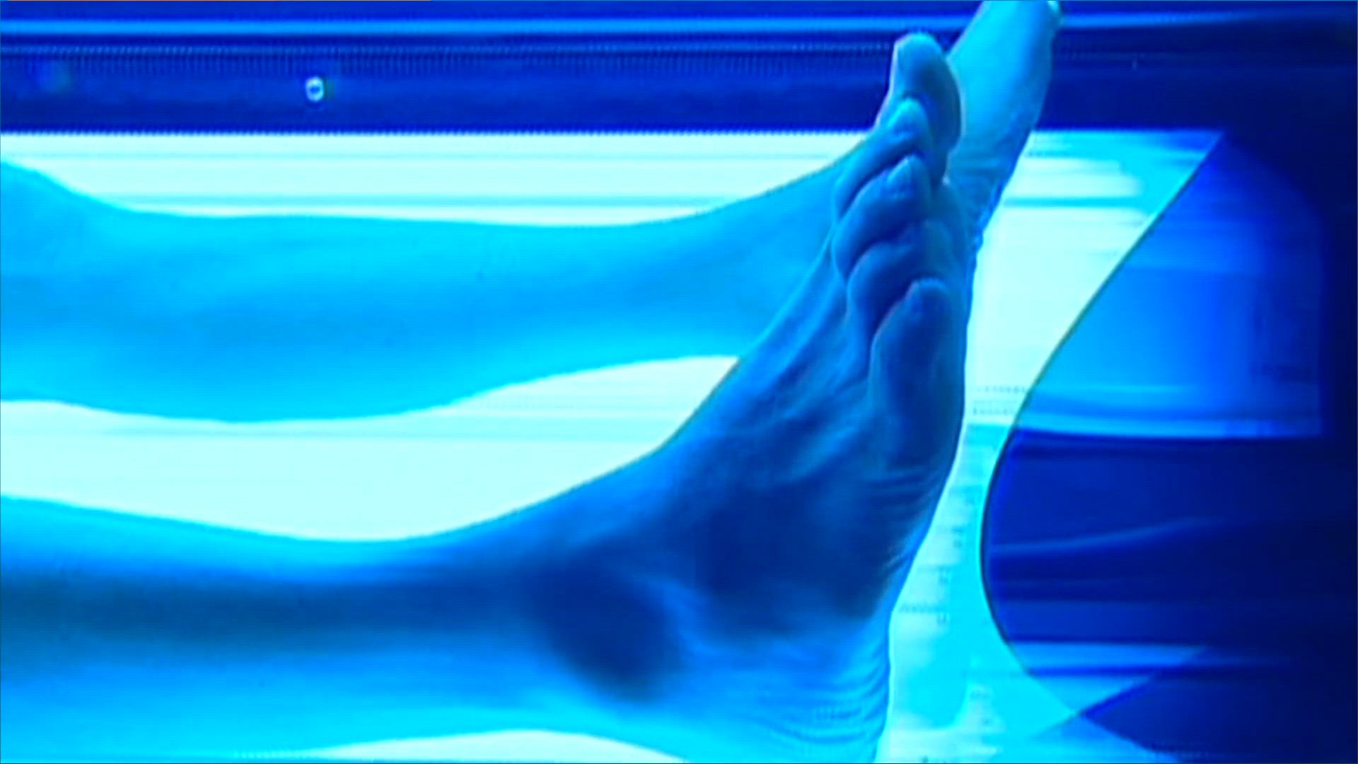 Dermatologists warn of dangerous tanning