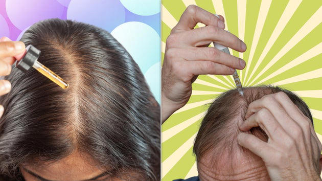 Everyone’s using minoxidil to prevent hair loss — but should they ...