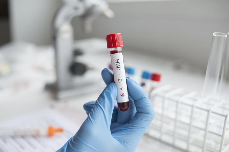 HIV atakuje coraz mocniej. Krakowski szpital ujawnia niepokojące dane o ...