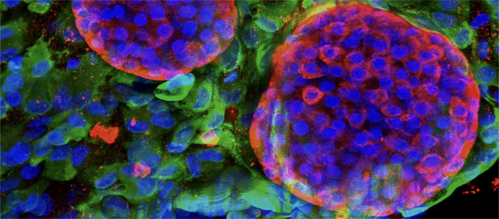💉 Diabetes: A protective gel for a future without insulin injections