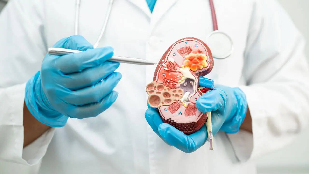The silent epidemic: Chronic kidney disease could become the world's ...