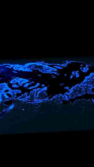 Blood vs luminol is insane