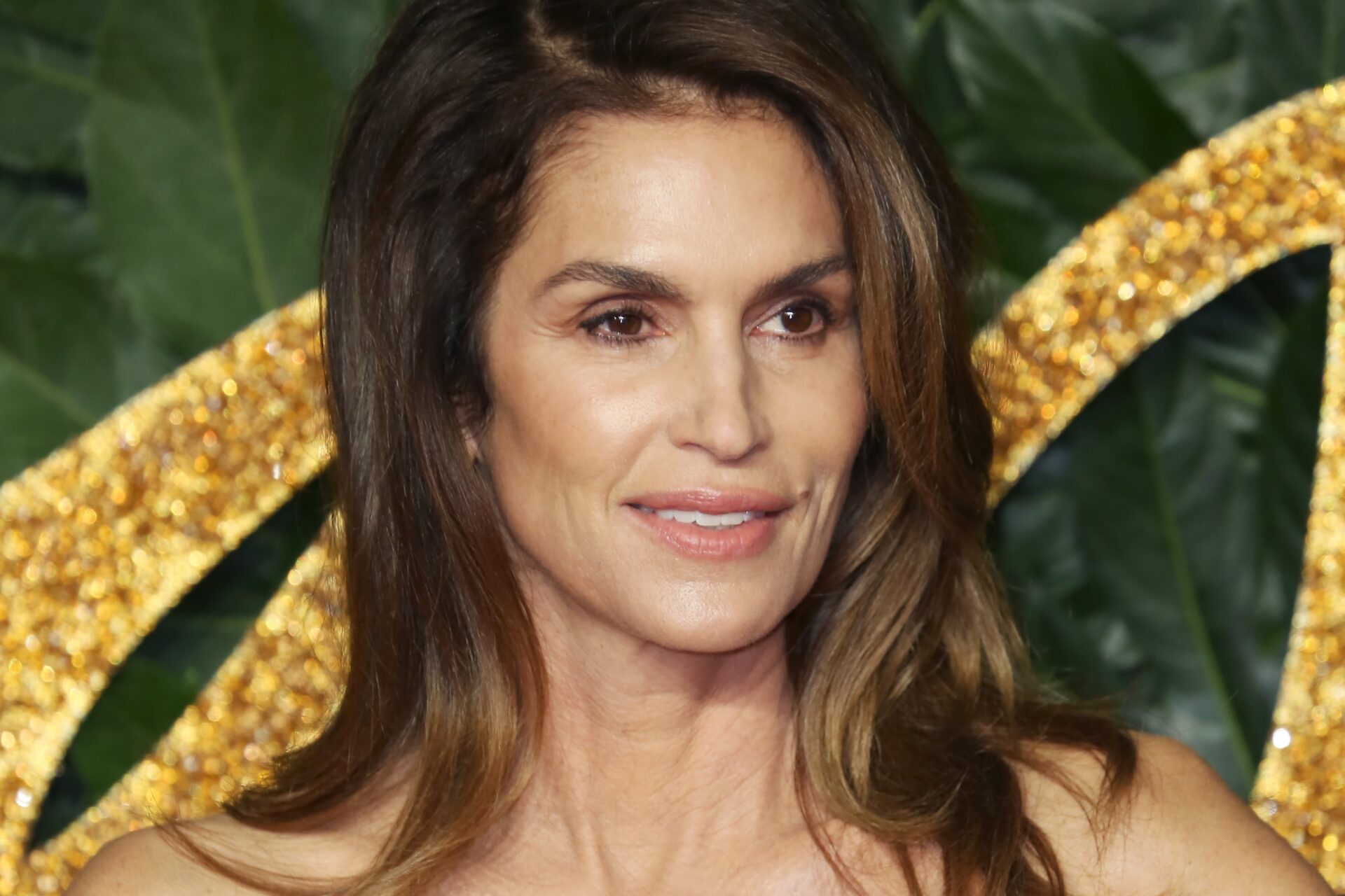 Cindy Crawford's struggle: 10 years with an eyelid condition