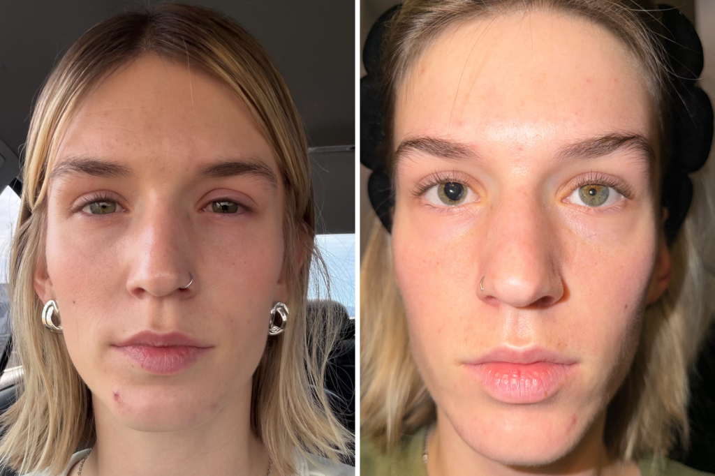 Woman hit in eye by Nerf gun while babysitting—here’s what happened after