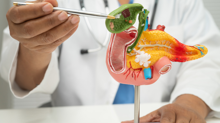 Most people miss the signs until it’s too late: What makes pancreatic ...