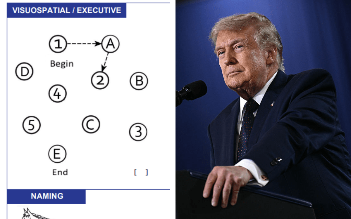 Trump got a "perfect" score on his cognitive test—so how do you compare?
