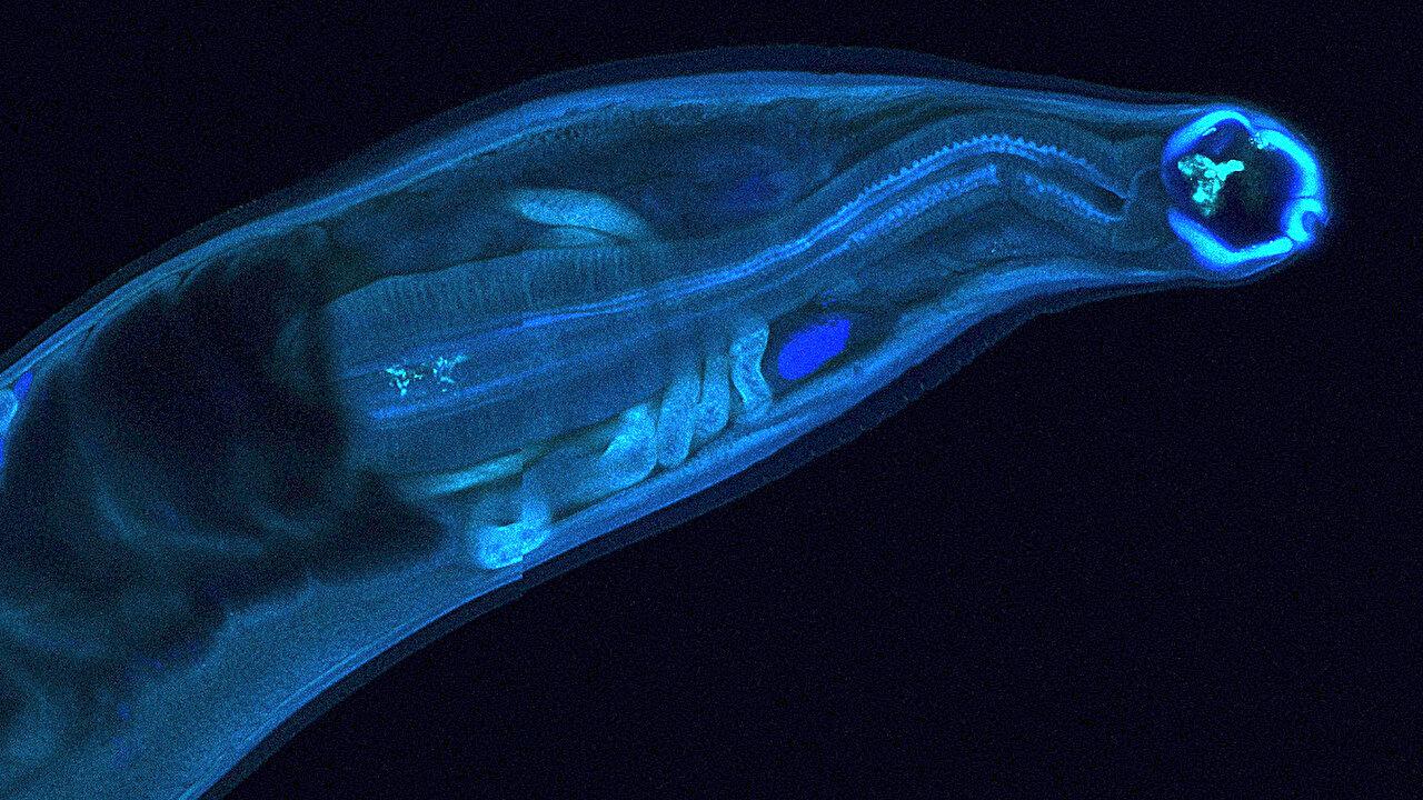 Genetically modified hookworms produce and deliver therapeutics