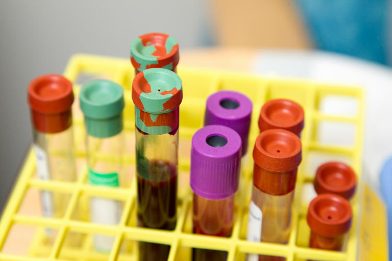 Vials found in large case at Detroit Airport: 2 researchers accused of ...