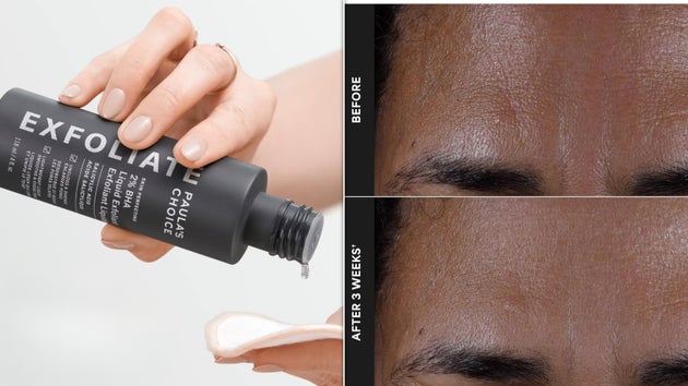 This bestselling exfoliant 'completely transformed my 51-year-old skin ...