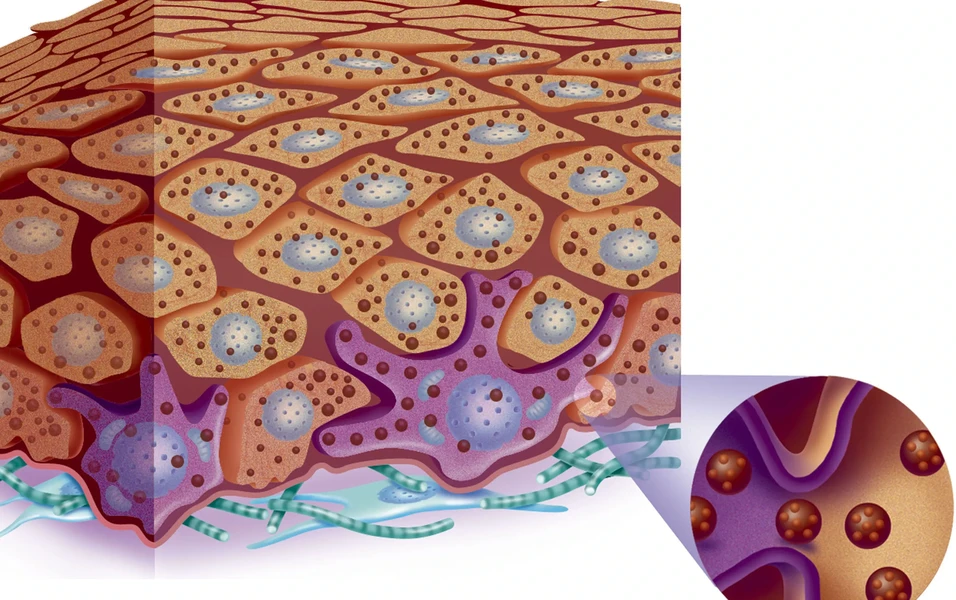 Melasma care tips dermatologists swear by