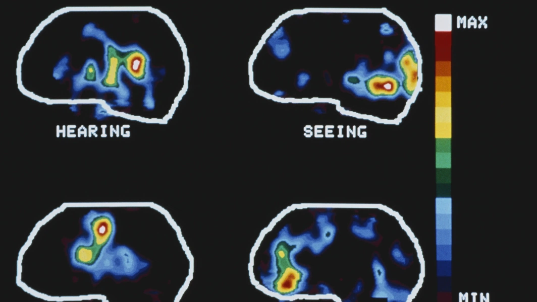 Study shows early visual experience reshapes brain feedback loops