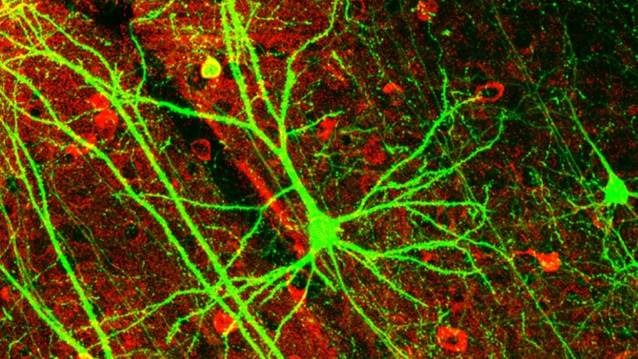Two cancer drugs — letrozole and irinotecan — reversed Alzheimer’s ...