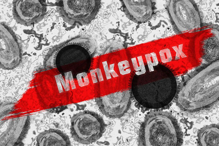 Shocking case: Scientists accused of smuggling deactivated MPOX virus ...