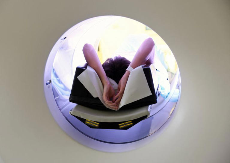 Health rounds: Radiation-emitting implant improves outcomes after brain ...