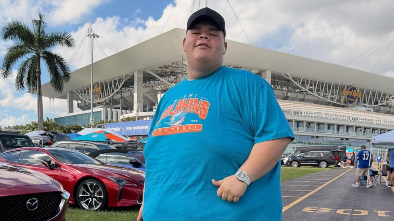 Gordão da XJ mostra antes e depois após perder 130 kg; compare