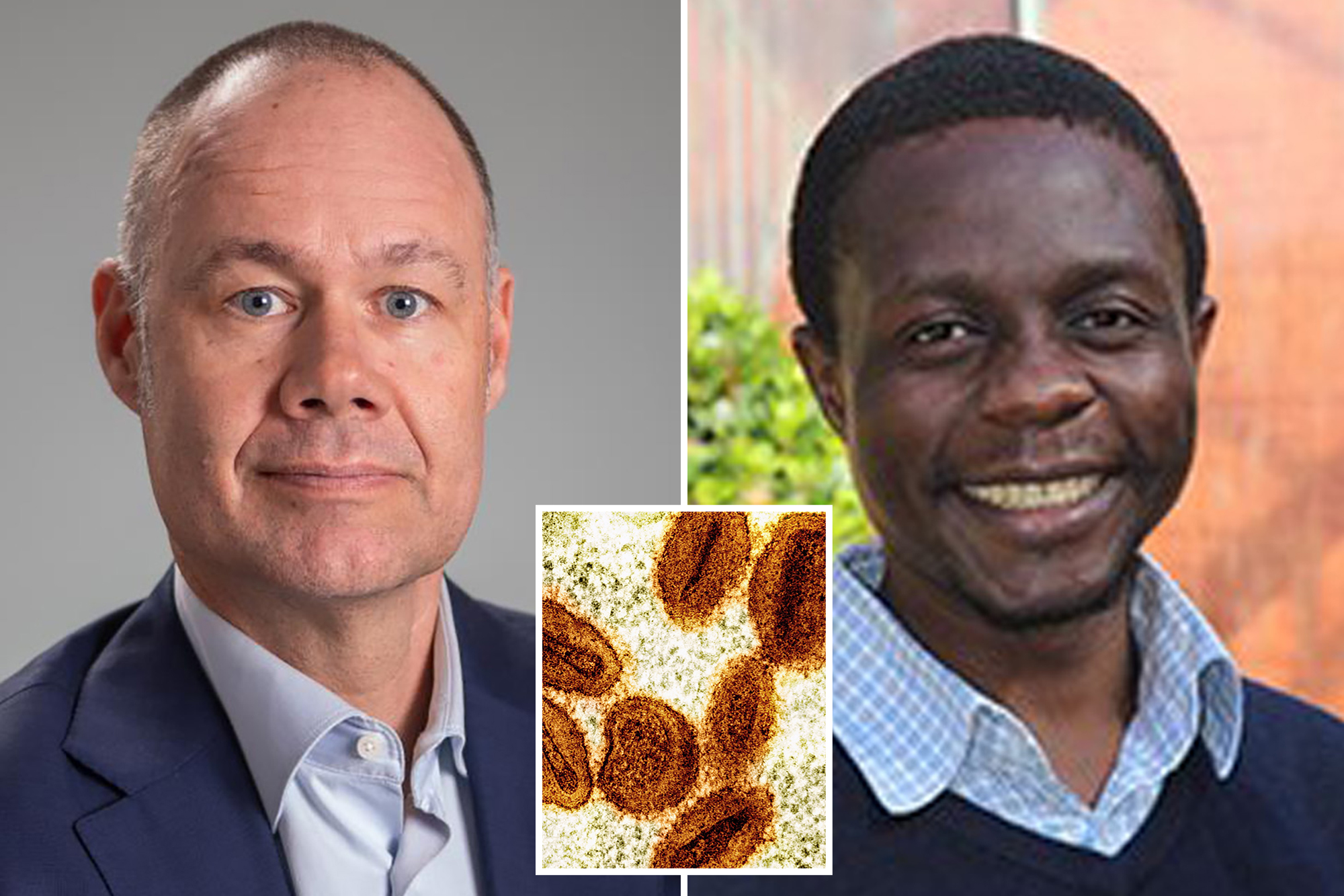 Scientists charged with bringing deactivated mpox virus into the US ...