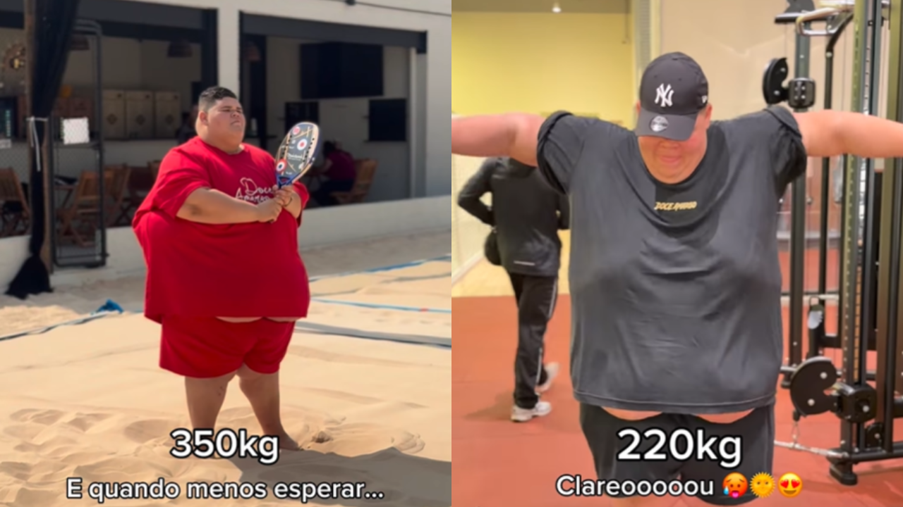 Gordão da XJ mostra antes e depois após perder 130 kg; compare