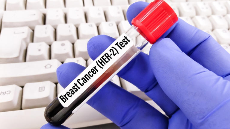 Roche’s giredestrant secures FDA priority review for breast cancer