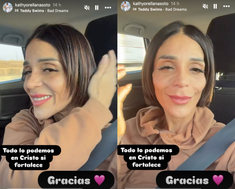 El radical cambio de look de Katherine Orellana tras grave problema de ...