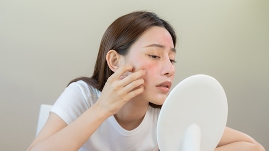 Breakouts in summer? Dermatologist warns you may be overwashing your ...