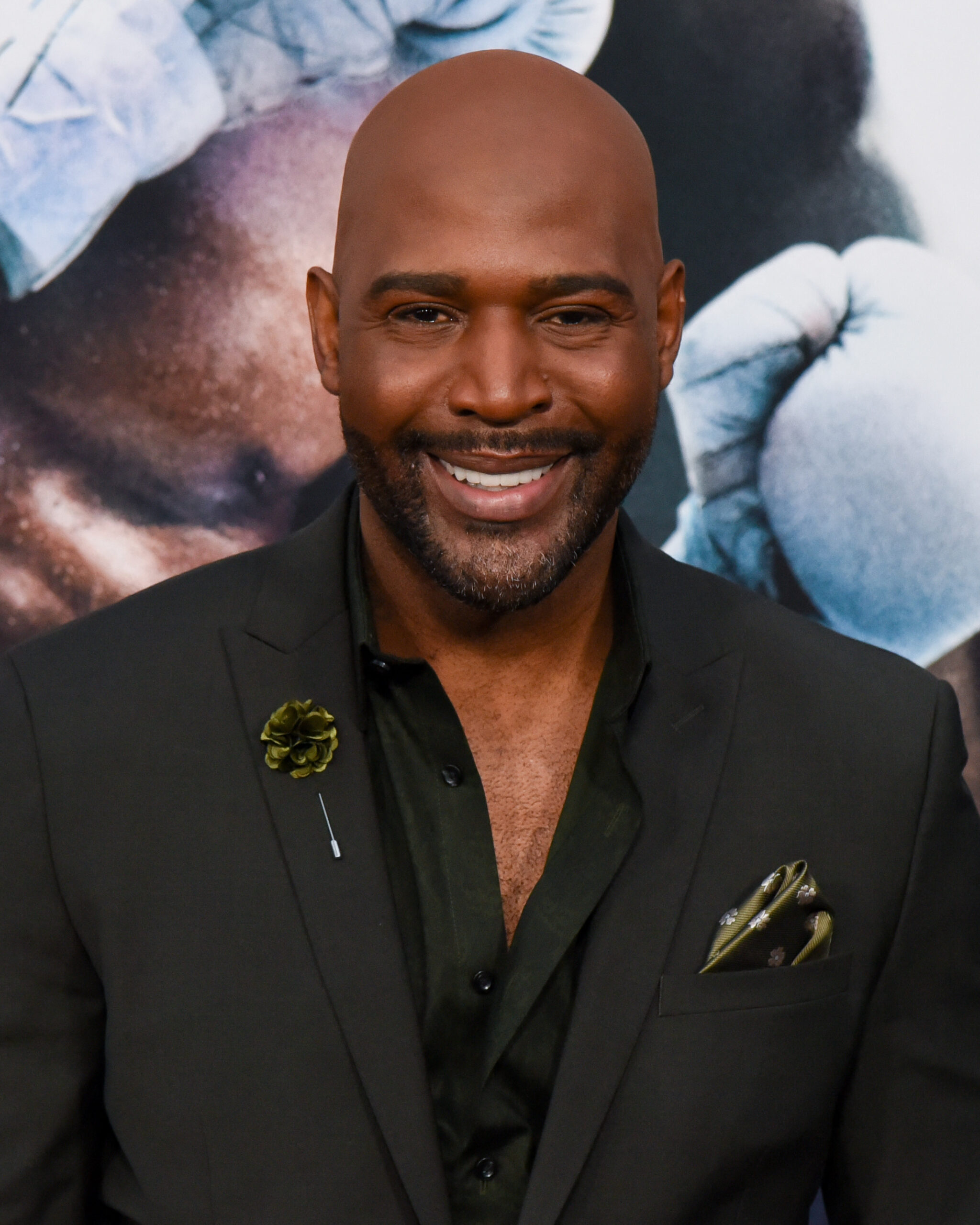 Karamo Brown says he 'stopped eating' after botched plastic surgery ...
