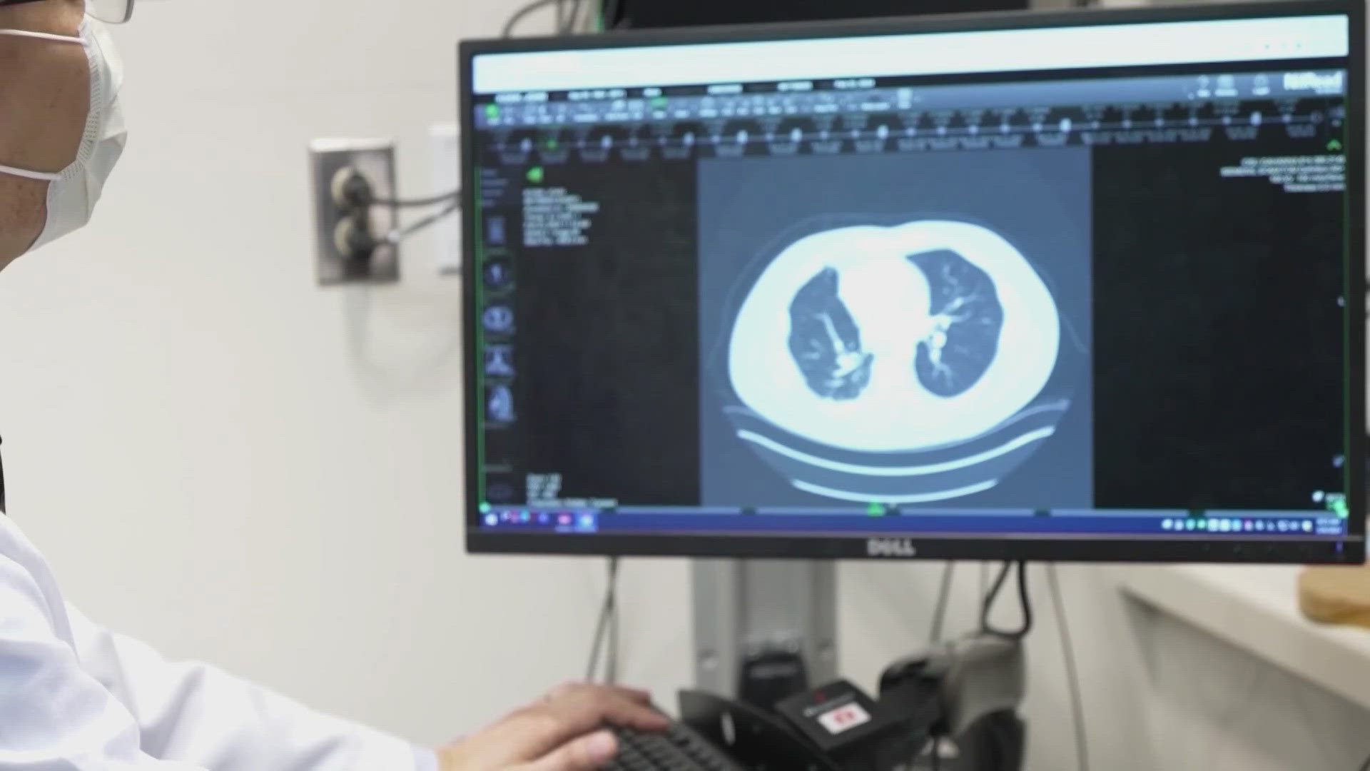 Healthy SA: Using AI to better your health