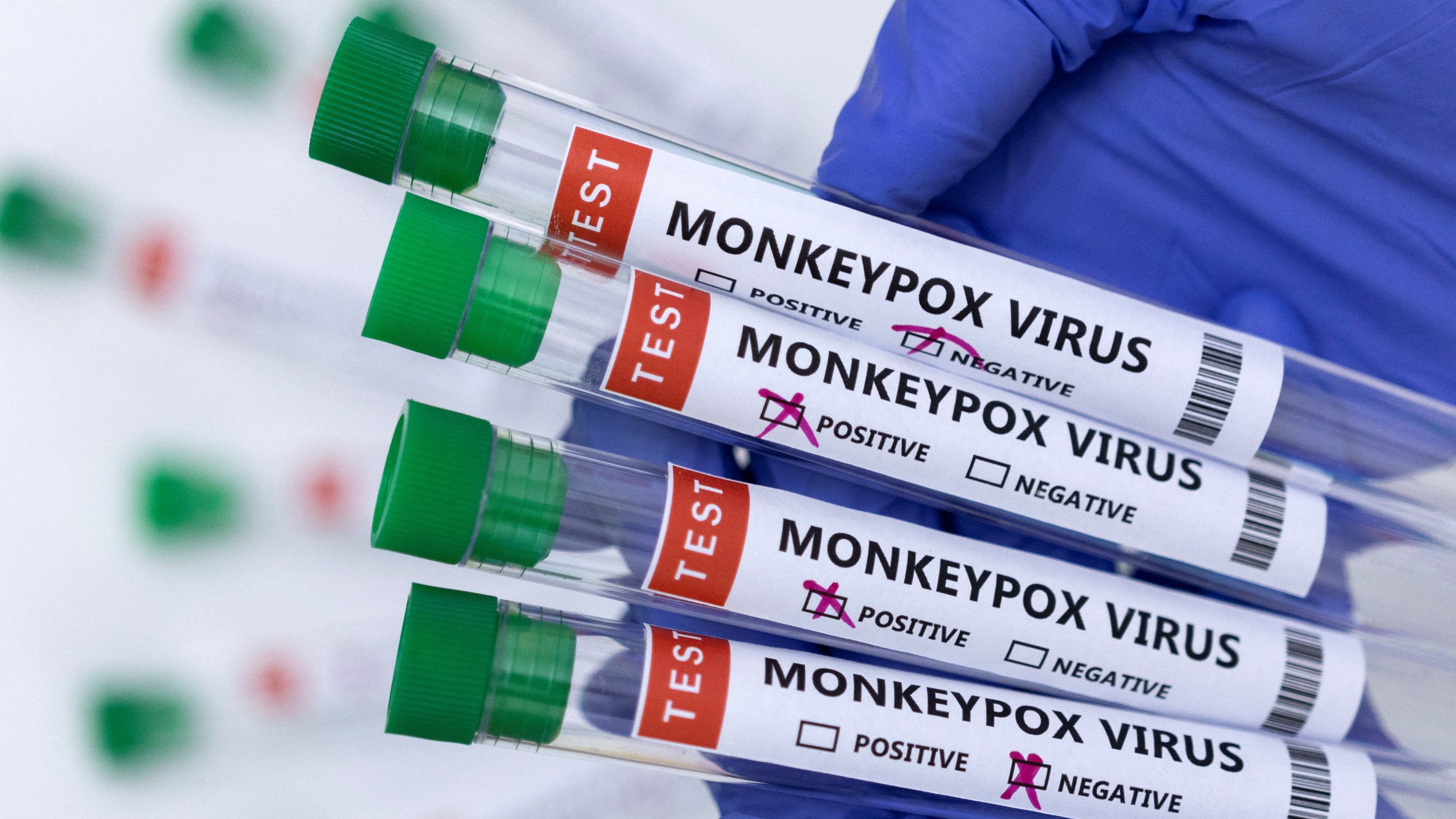 Deadly virus found in luggage at US airport