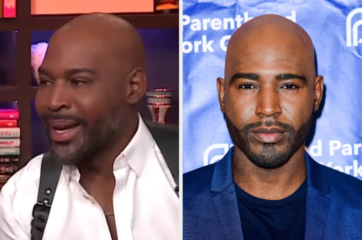 Karamo Brown reveals emotional reason he kept his botched plastic ...
