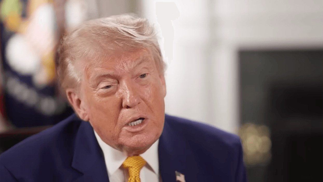 Pre-taped Trump appearance reveals new medical malady he can’t hide