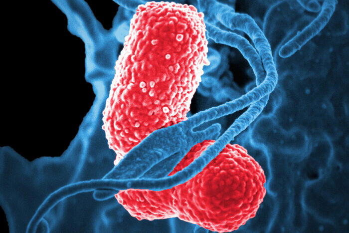 New antibiotic kills drug-resistant bacteria by targeting previously ...