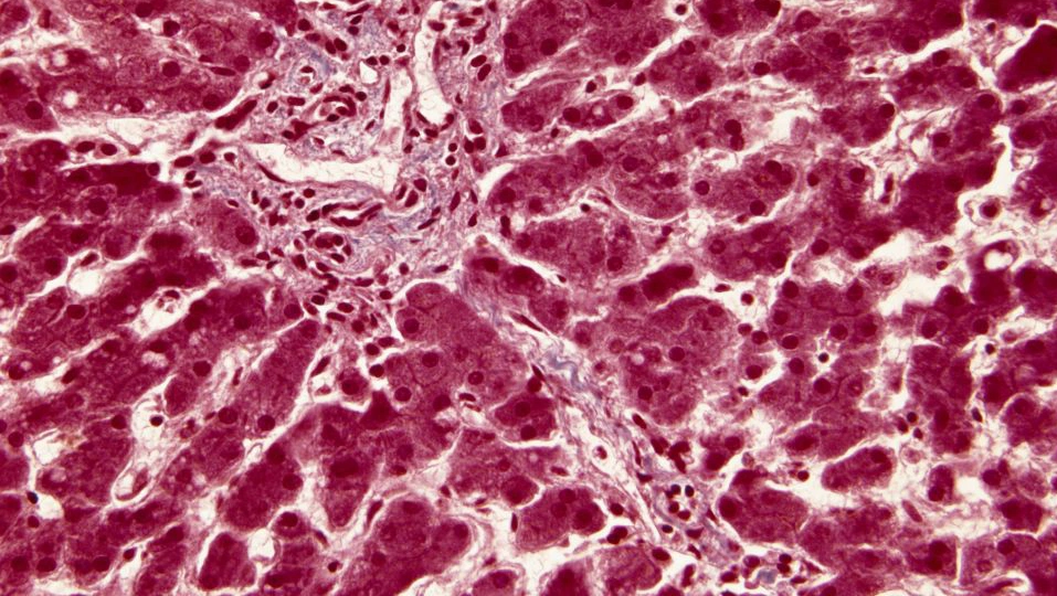 How the liver recovers after alcohol damage