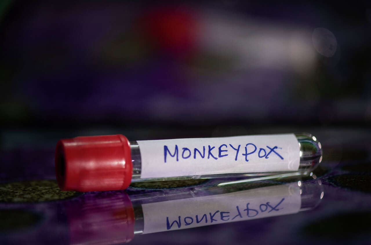 NIH researchers accused of smuggling monkeypox samples through Detroit ...