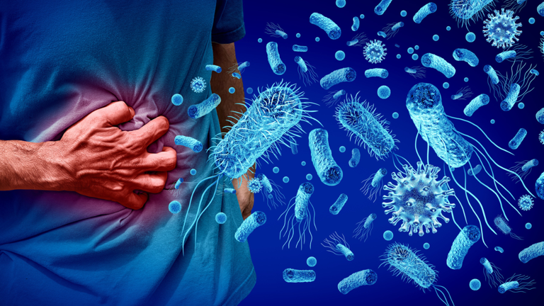 Norovirus spreading across US: What to know about the highly contagious ...