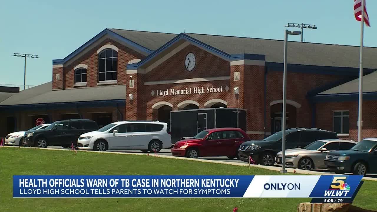 Health Department investigates tuberculosis case at Lloyd Memorial High ...